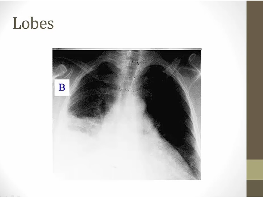 01 Pulmonary Anatomy · GitBook